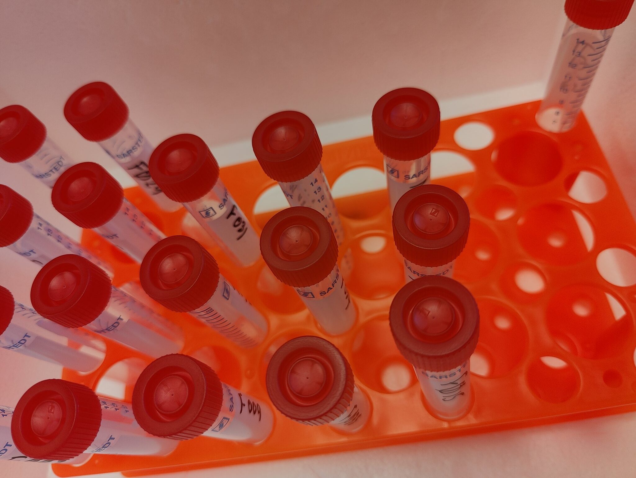 Marignani Discovery Research Laboratory - Marignani Lab begins ...